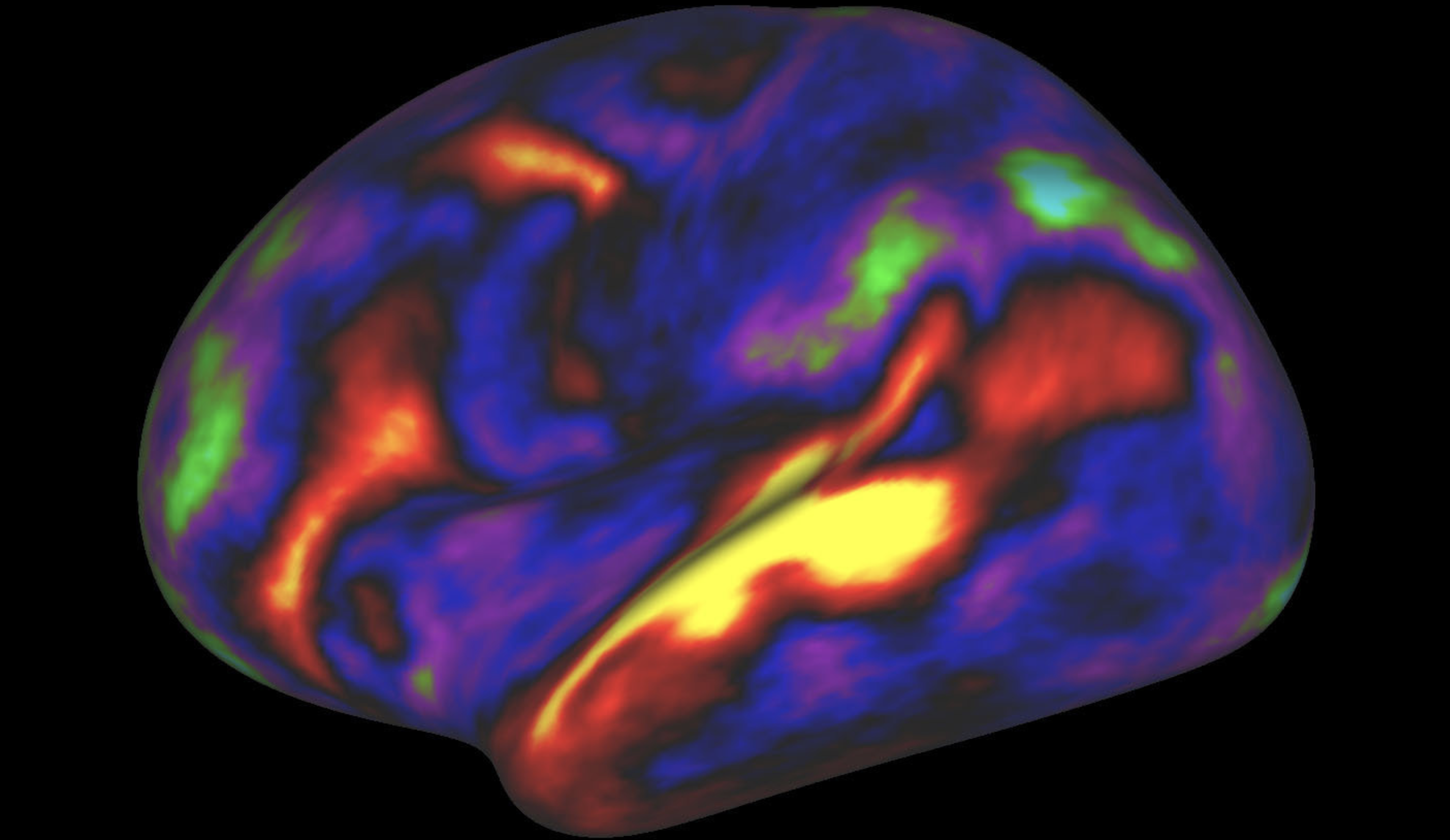 Stunning New Map Of The Brain Shakes Up Neuroscience Big Think stunning-new-map-of-the-brain-shakes-up-neuroscience-big-think