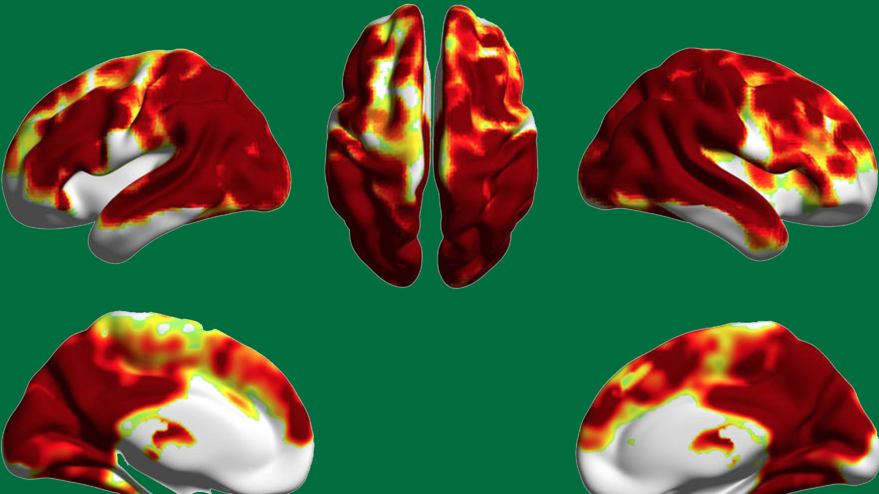 Caffeine reduces brain blood flow. So how does it energize our minds ...