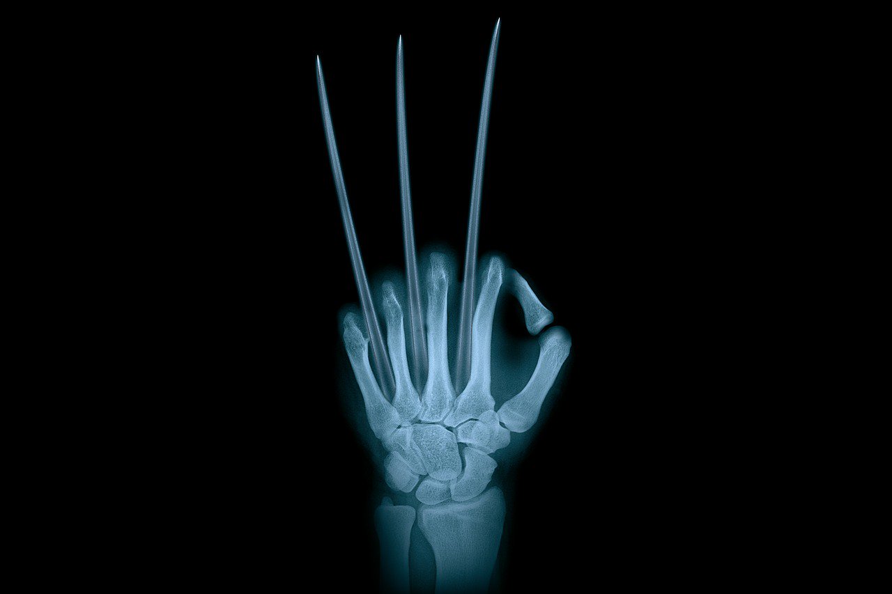 7 actual superpowers certain humans have, due to genetic mutation - Big ...