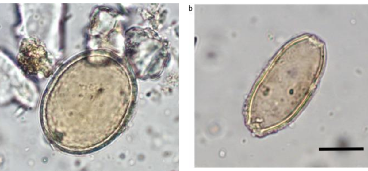 Medieval friars were possessed by parasites - Big Think